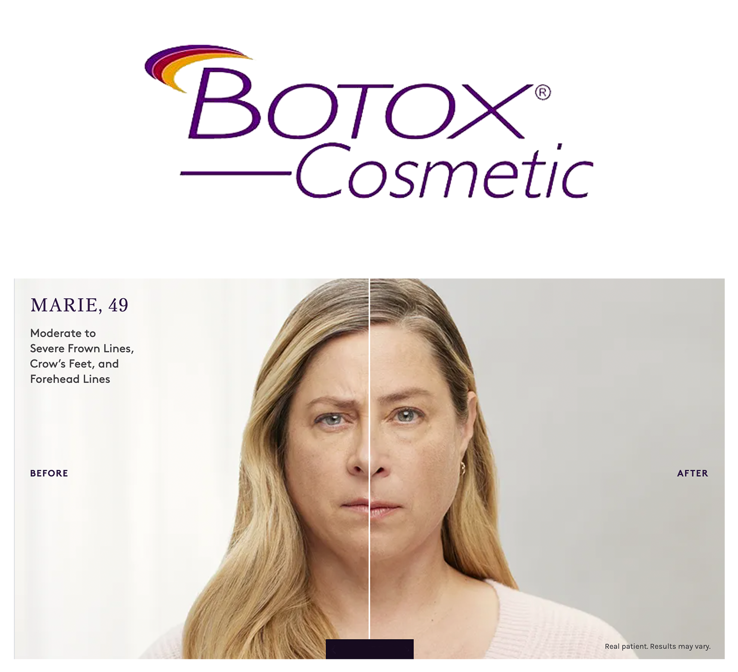 Cosmetic Injectables – NuYou Aesthetics & Weight Loss