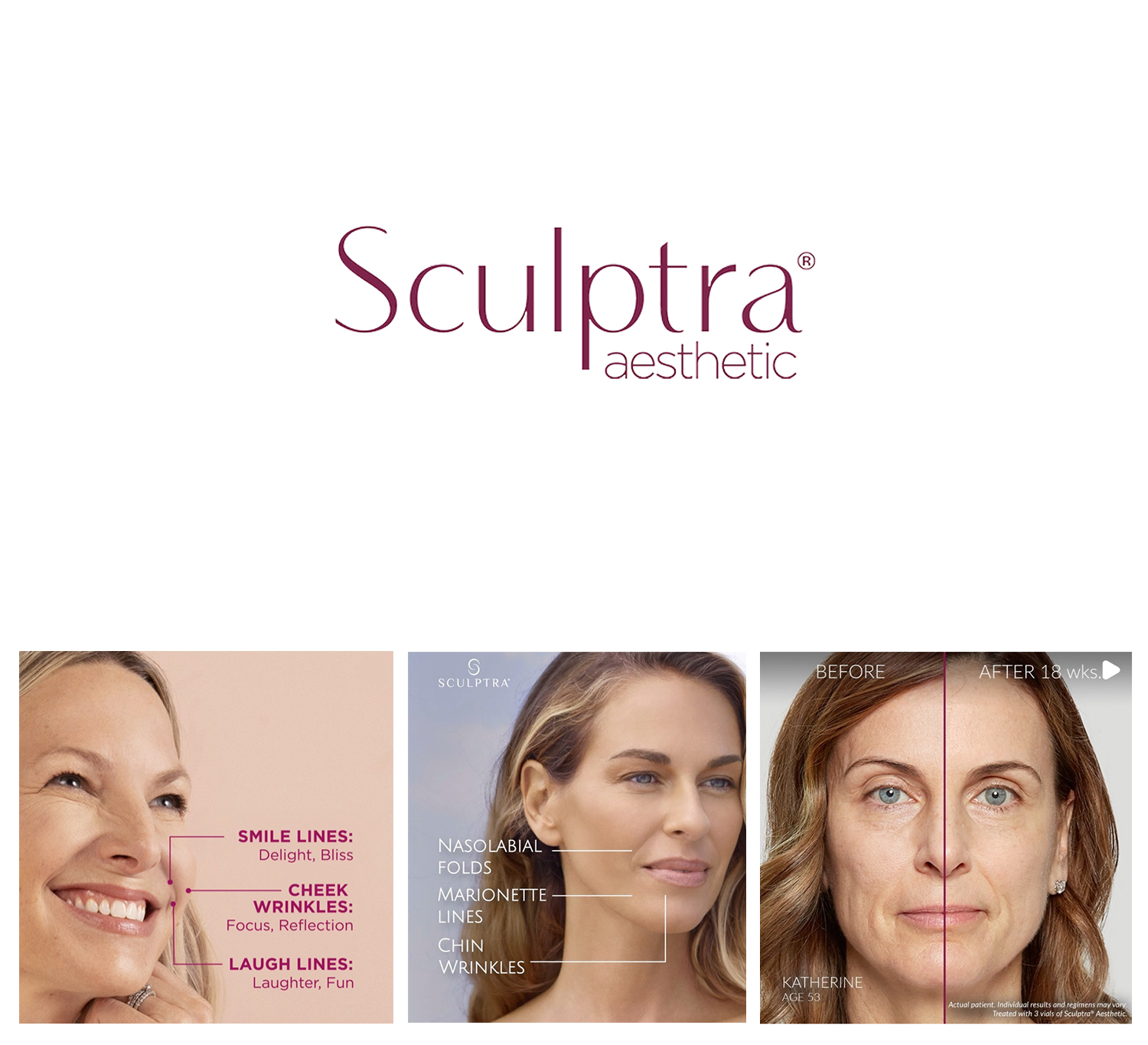 Cosmetic Injectables – NuYou Aesthetics & Weight Loss